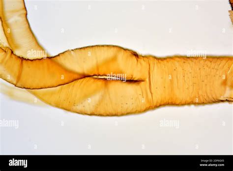 Trachée Dinsectes Microscope Optique X100 Photo Stock Alamy