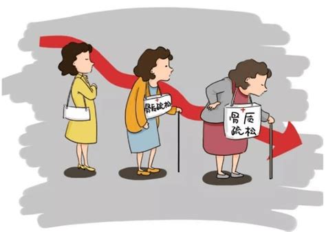 围绝经期和绝经后妇女骨质疏松症防治选择 治疗 版权 风险