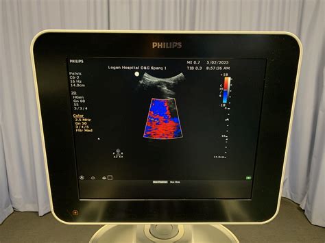 Philips C6 2 Broadband Curved Array Probe Ultrasound Transducer For Sparq Auschoice