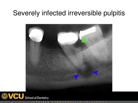A P Value Aint What You Think It Is Al M Best Phd Ppt Download
