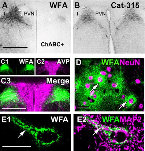 Ecm Structures In The Pefah A Wfa Green And Neun Magenta
