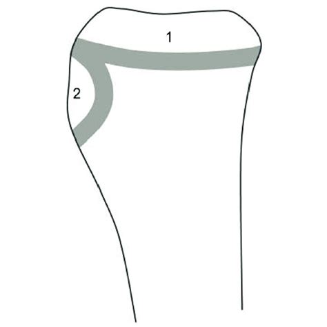 Ossification Centers Of Proximal Tibia Download Scientific Diagram
