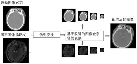 Multi Modal Brain Image Registration Method Based On Improved Image Pyramid Eureka Patsnap