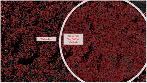 How To Create Segmentationsurfacecell Detection If The Cell Density Is Too High Using Qupath