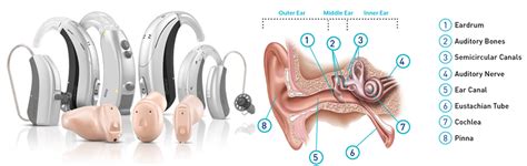 Phonak Hearing Aids Different Models And Hearing Loss Products