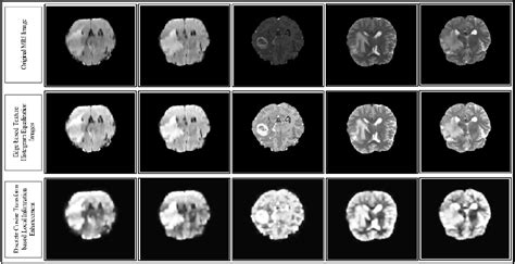 Figure 1 From Multimodal Brain Tumor Classification Using Deep Learning And Robust Feature