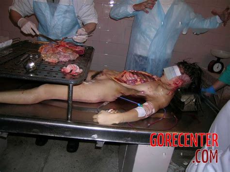 MIX Naked And Dead Women On The Dissection Table GoreCenter