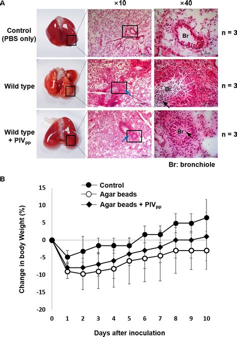 Pseudomonas Aeruginosa Infection