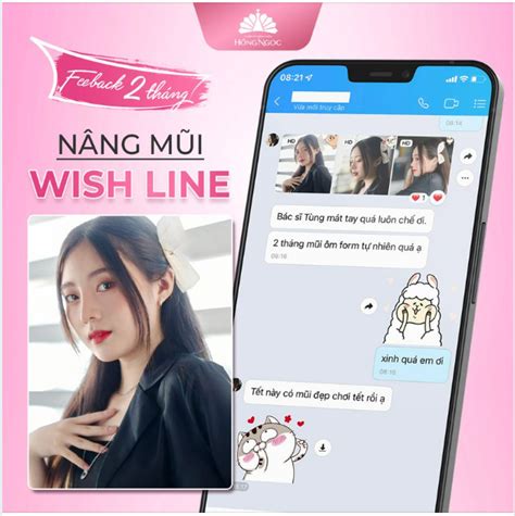 Hơn cả mong đợi khách hàng gửi Feedback khoe dáng mũi Wish Line đầy thần thái