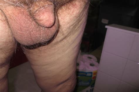 The Evolution Of A Shrinking Penis Pics XHamster
