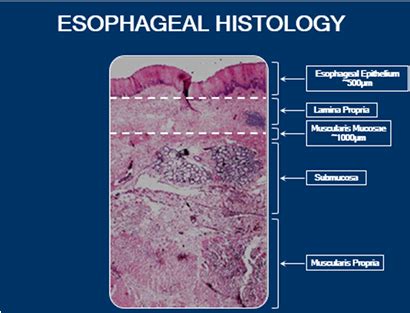 Histology Esophagus Layers Histology Slides Pharynx Esophagus And