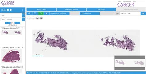 openseadragon open source web viewer and javascript library for high