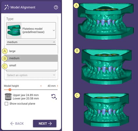 Filemodel Alignment Fr 5png Exocad
