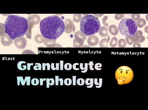 Metamyelocyte Vs Monocyte