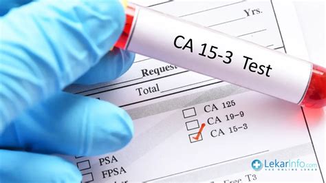 Ca 15 3 • Lekarinfo