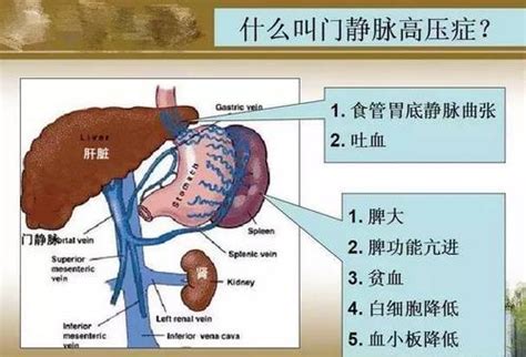 中医的脾和现代医学的脾脏有什么不同 艾灸