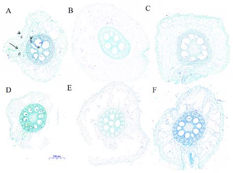 Effects Of N Application Rates On Root Microstructure Of Maize In The Download Scientific
