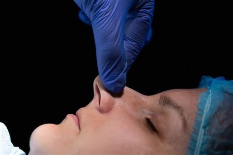 Exploring The Connection Deviated Nasal Septum And Dental Health