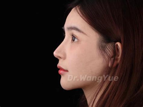 上海牙齿矫正 正畸美学修复联合，定制个性化甜美笑容 知乎