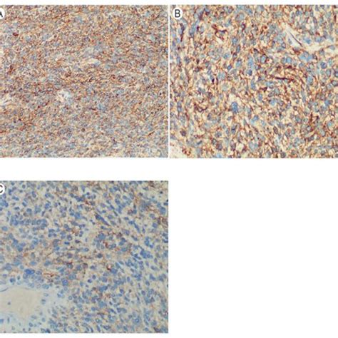Nih Fletcher Criteria For Gist Risk Assessment Download Table