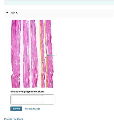 Solved Identify The Highlighted Structures
