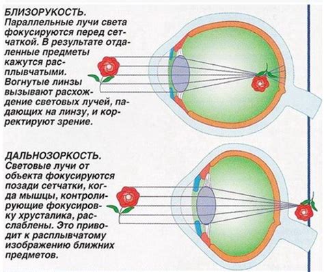 Астигматические контактные линзы: отзывы, цены, можно ли носить обычные ...