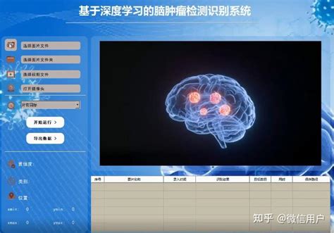 深度学习目标检测算法yolov8训练医学类脑肿瘤数据集识别四种脑肿瘤类别检测 构建基于深度学习的脑肿瘤检测识别系统 知乎