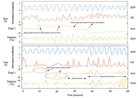 Respiratory Waveforms Of The Proposed Ultrasound System Us In Download Scientific Diagram