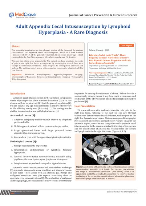 Pdf Adult Appendix Cecal Intussusception By Lymphoid Hyperplasia A Rare Diagnosis