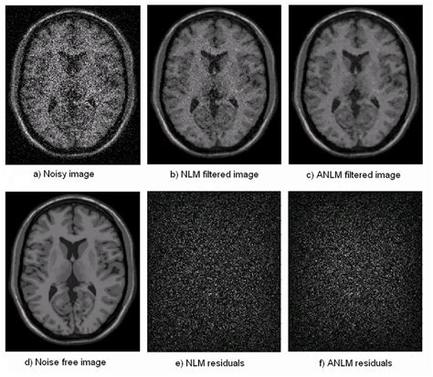 Denoising Results Of The Nlm And Anlm Filters Applied To Spatially Slow Download Scientific