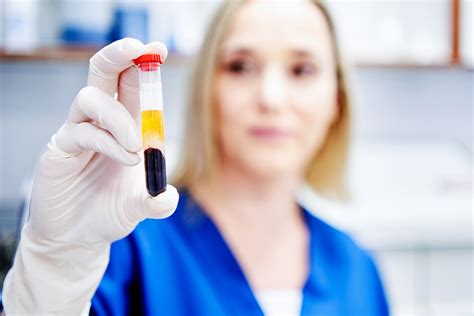 Cidp Mayo Clinic Press