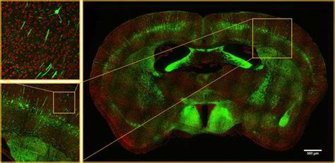 小鼠鼠脑冠状面神经元精细双色图东方闪光（北京）光电科技有限公司