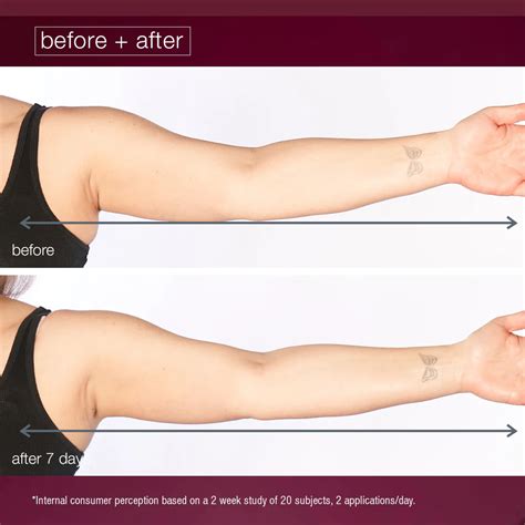 Dynamic Skin Sculptor Fruition Skin Therapy