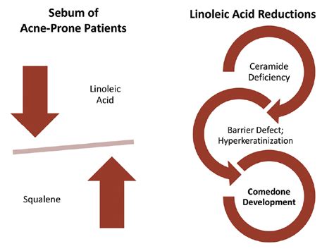 Hyperkeratinization Acne
