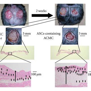 ACM Containing ASCs Or ACM Alone Was Applied To Each Wound By Suture Download Scientific