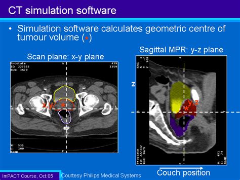 Ct Simulation Software 3