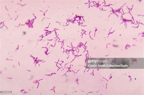 This Micrograph Depicts The Gram Positive Bacterium Bifidobacterium
