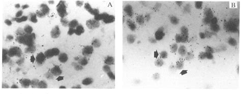 Structure Of Suprachiasmatic Nucleus Semantic Scholar