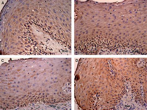 Figure 1 From The Role Of Toll Like Receptor 2 And 4 In Gingival Tissues Of Chronic