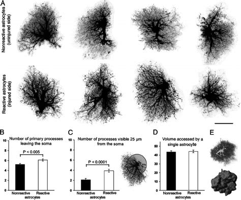 Morphological Assessment Of Reactive And Nonreactive Astrocytes In The Download Scientific