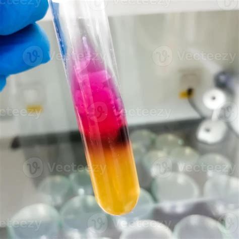 Salmonella Detection Method By Using Triple Sugar Iron Or Tsi Agar In Microbiology Laboratory