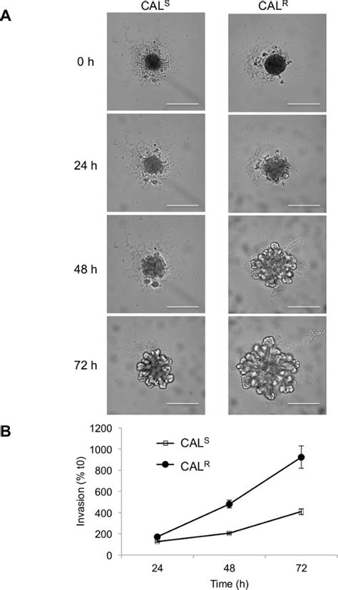 Three Dimensional 3d Tumor Spheroid Invasion Assay Scientific Article