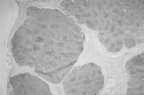 Chapter 3 Synovial Tissue Orthogate Press
