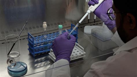 Video Extraction And Estimation Of Total Siderophore Pyoverdine And Pyochelin From