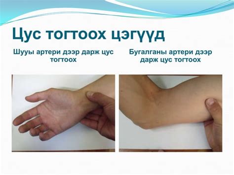 цус алдалтын үед үзүүлэх анхны тусламж Pptx