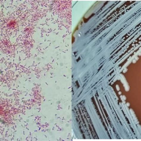 Cerebrospinal Fluid Gram Stain And Chocolate Agar With Gram Negative