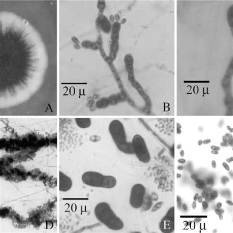 Pdf Characterization Of Aureobasidium Pullulans Isolated From Airborne Spores In Thailand