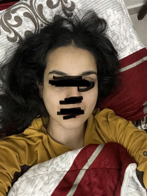 Why Does My Skin Look So Sallow R Skincareaddicts
