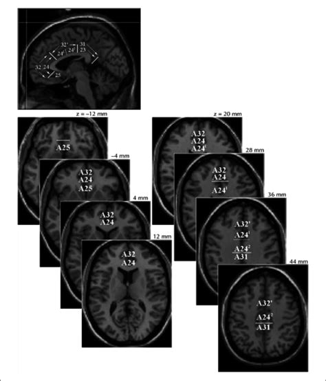 Shows The Subregions Of The Anterior Cingulate Ac Cortex In The Download Scientific Diagram