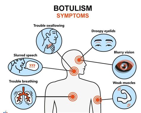 Clostridium Botulinum Symptoms